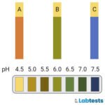Urine pH test : Procedure, Causes (Normal, Low, High) and Clinical ...