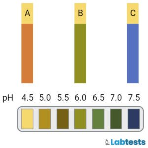 Urine pH test : Procedure, Causes (Normal, Low, High) and Clinical ...